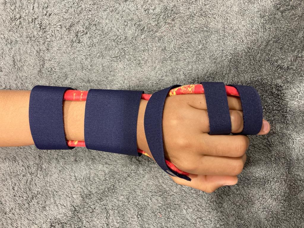 Repos poignet main doigts – Aix Orthèses